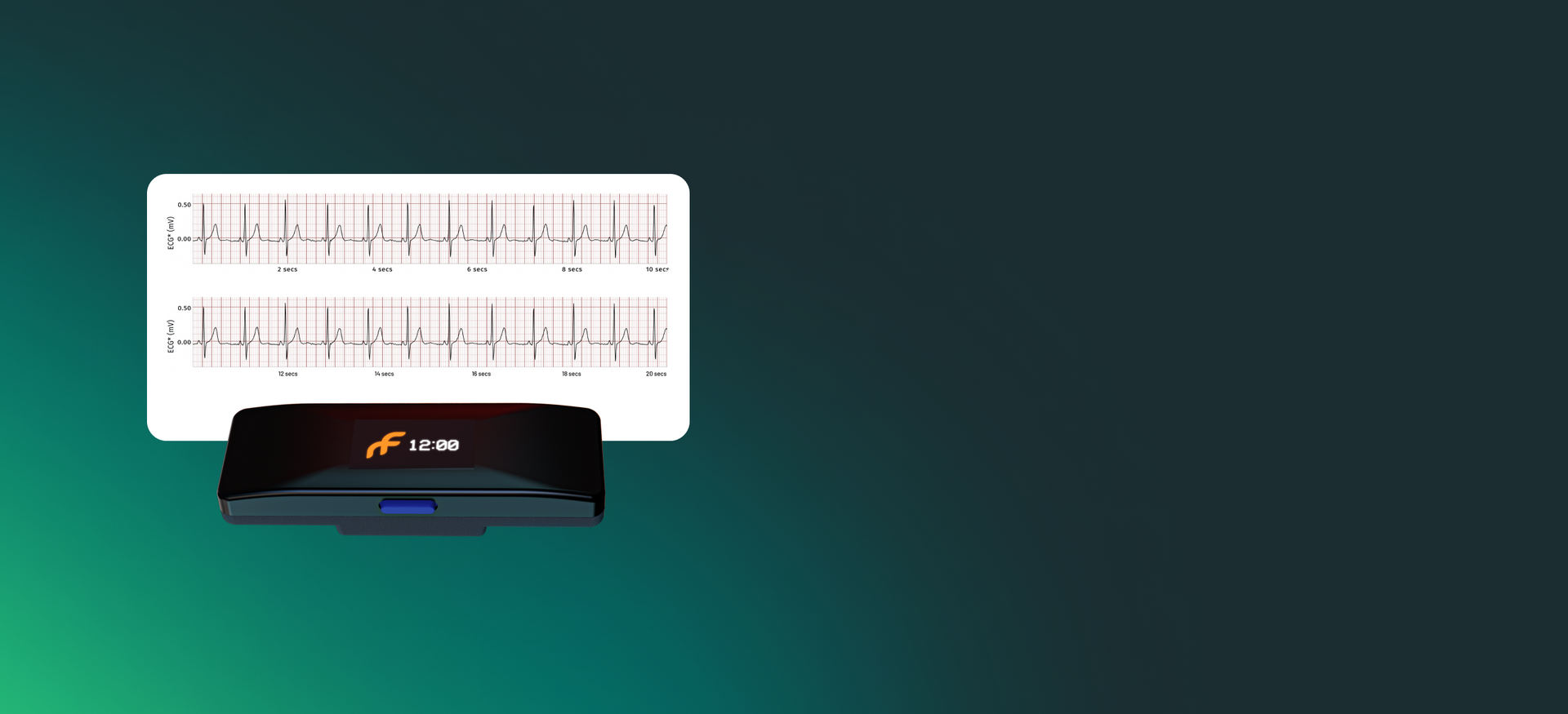 The Power Of 24 Hours Continuous ECG | Frontier X2