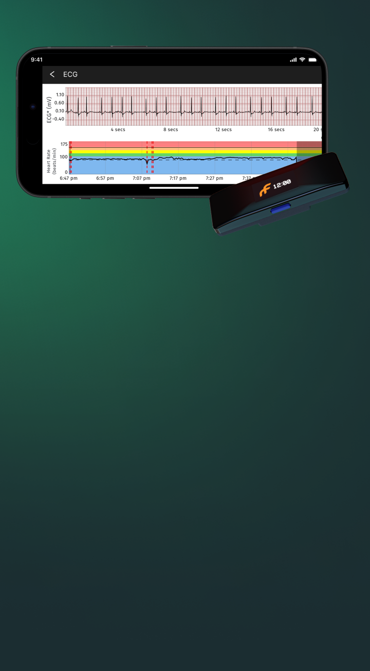 Optimize Workouts With ECG During Exercise | Frontier X2