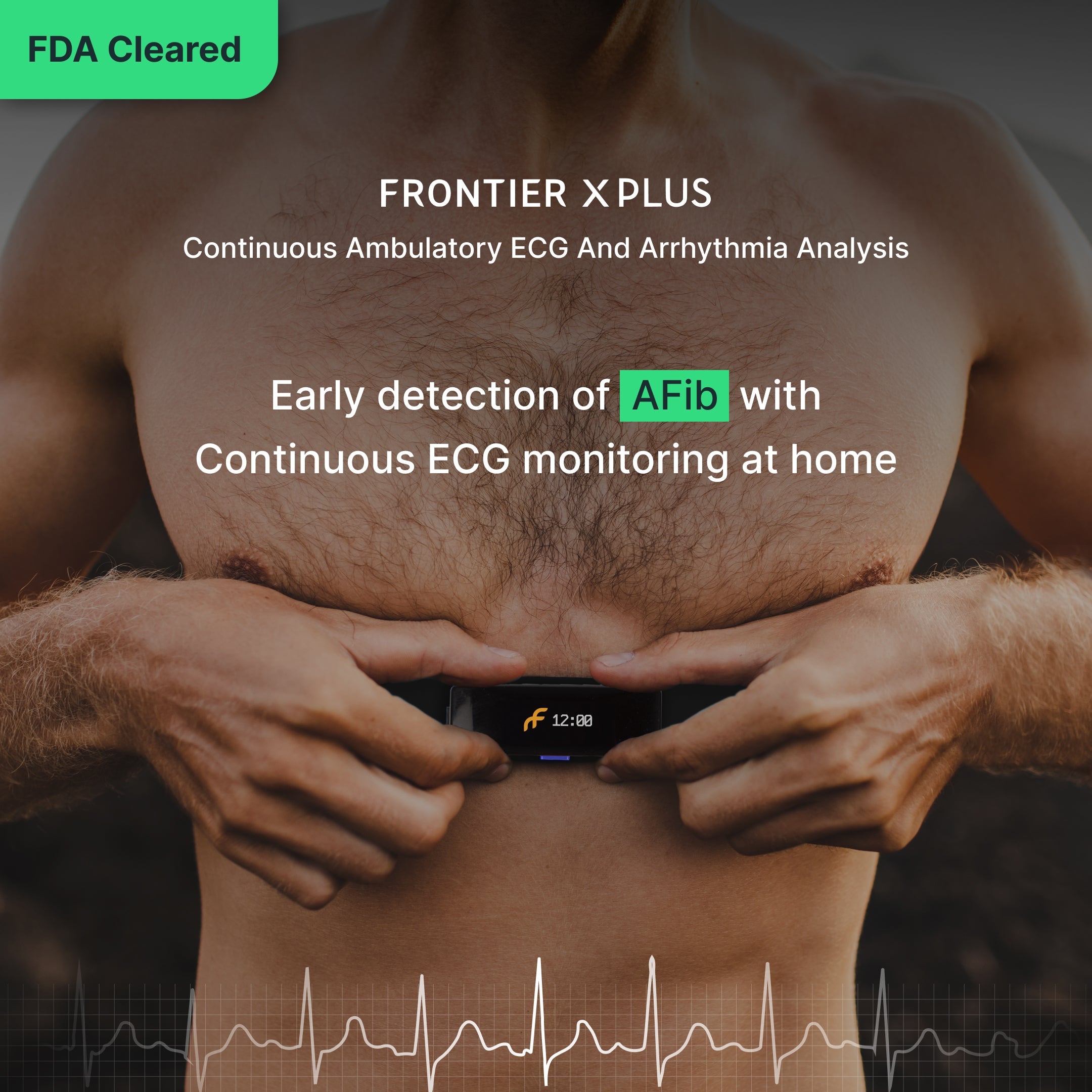 Frontier X Plus | FDA-Cleared Medical Grade ECG for Afib Detection
